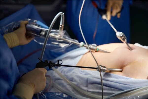 Laparoscopic hysterectomy in Chandigarh | Uterus Removal Surgery